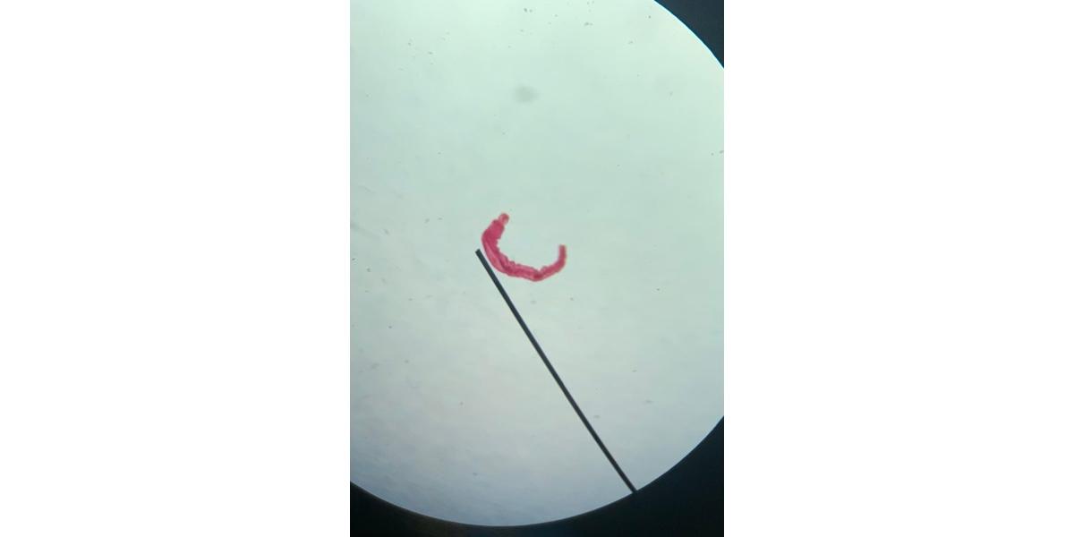 Solved What is the identification of this parasite? I | Chegg.com