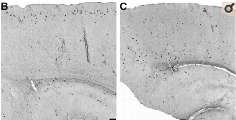 Solved BrdU labeling is examined in wild-type mouse brains | Chegg.com