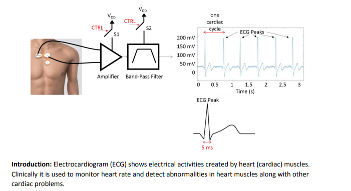 VOD Voo CTRL one cardiac cycle CTRL S2 ECG Peaks 200 | Chegg.com