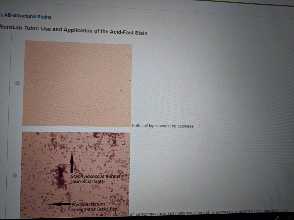 Solved Hi, LaurenSign OutA Home AB-Structural Stains croLab | Chegg.com