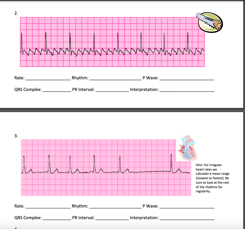 Solved Rate: Rhythm: P Wave: QRS Complex: PR Interval: | Chegg.com