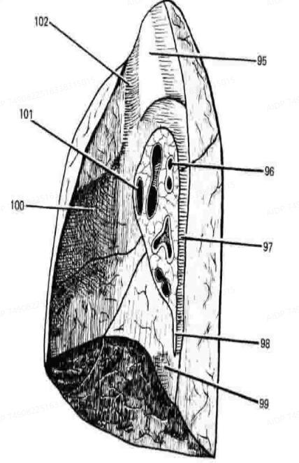 Solved In the Section of Right lung, identify the 96 | Chegg.com