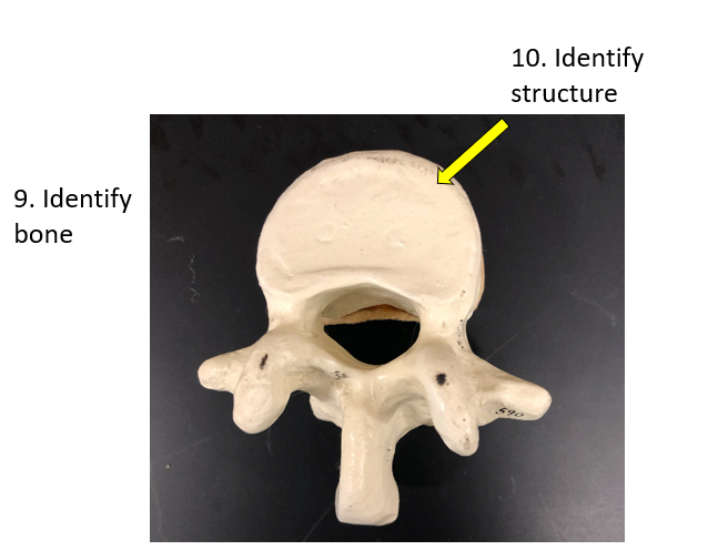 Solved 10. Identify structure 9. Identify bone | Chegg.com