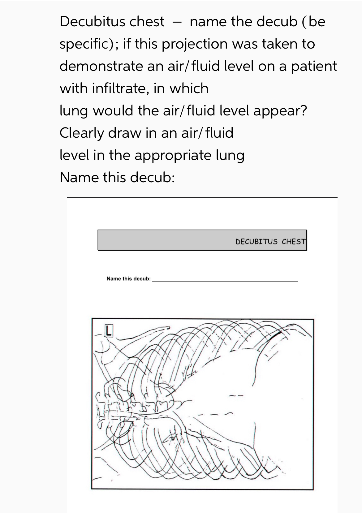 Solved Decubitus chest - ﻿name the decub (bespecific); if | Chegg.com