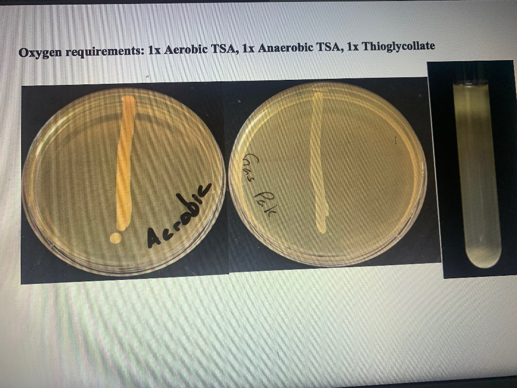 Solved Observing the Thioglycollate broth tube, Aerobic TSA | Chegg.com