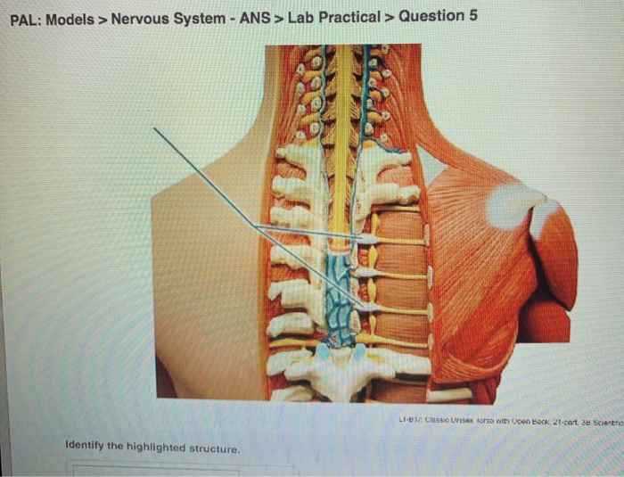 Solved PAL: Models > Nervous System - ANS > Lab Practical> | Chegg.com