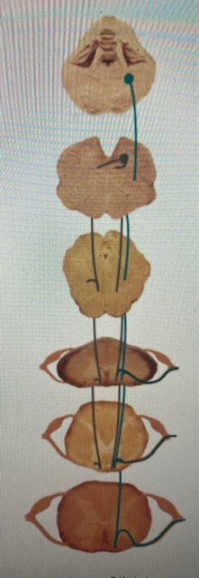 Solved Larry is balancing on a ladder. He is reaching his | Chegg.com