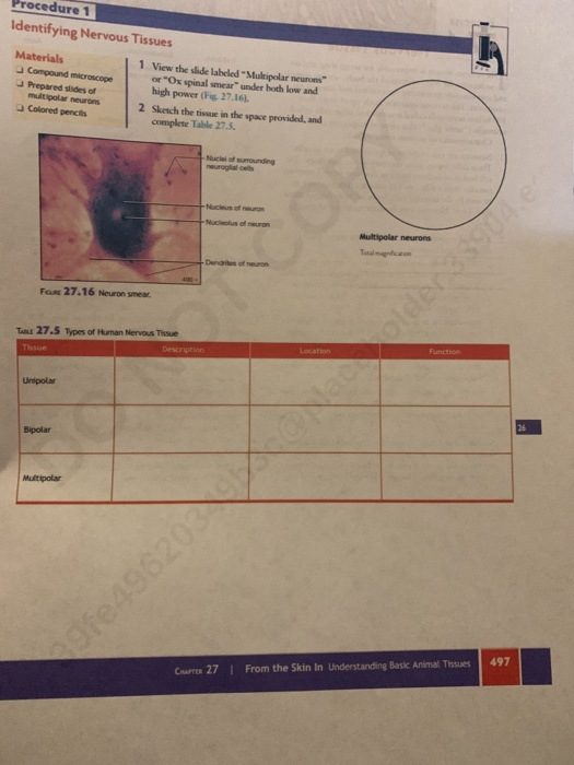 Multipolar Neuron Labeled Under Microscope