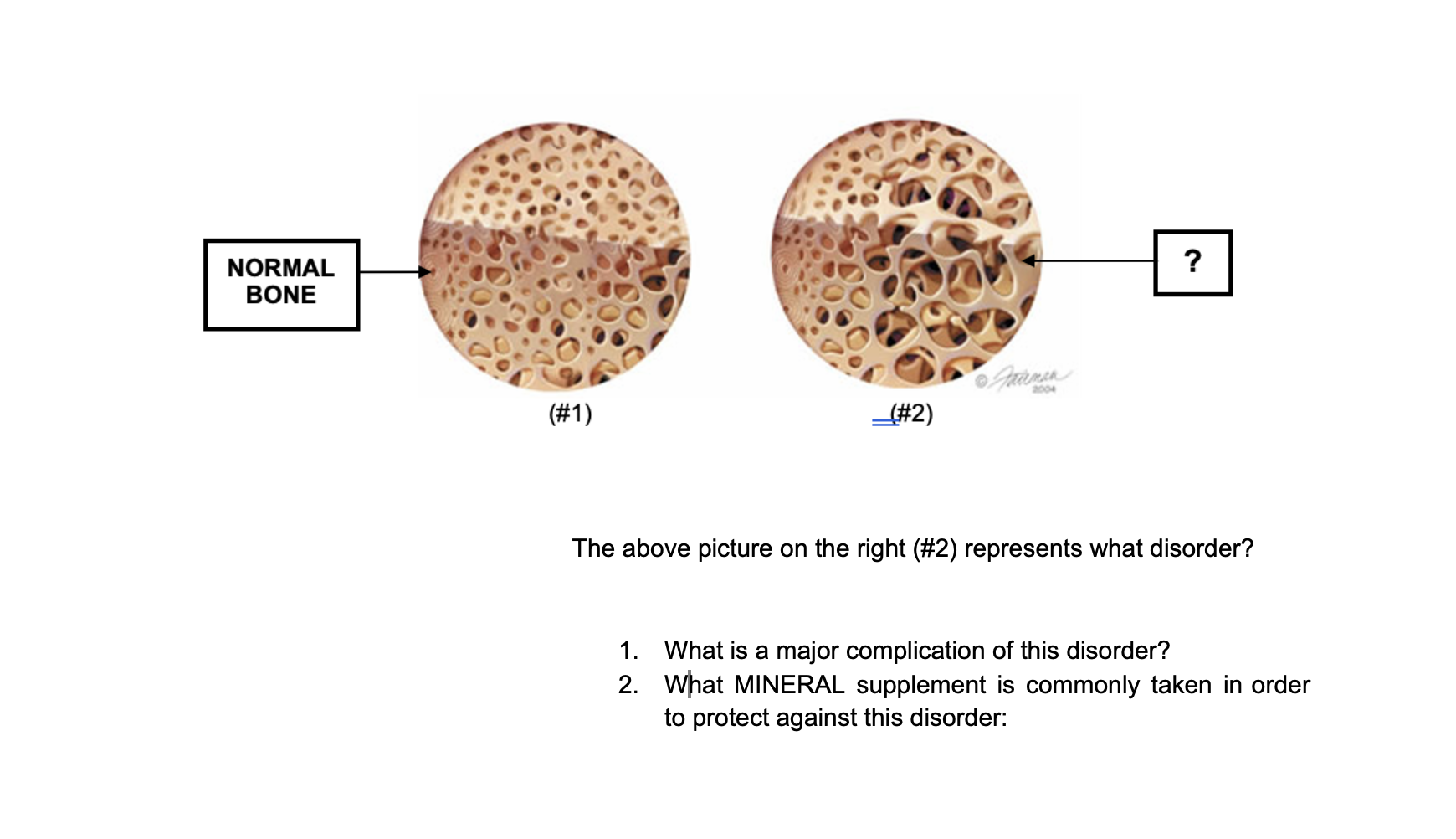 Solved ? NORMAL BONE Primer (#1) _(#2) The above picture on | Chegg.com