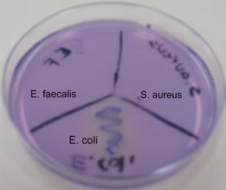 Using Differential, Selective, and Enriched Media 14 | Chegg.com