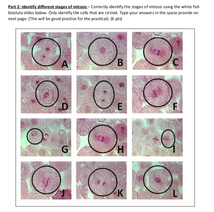 Hard Test On Identifying Stages Of Mitosis Hard Test On Identifying Stages Of Mitosis