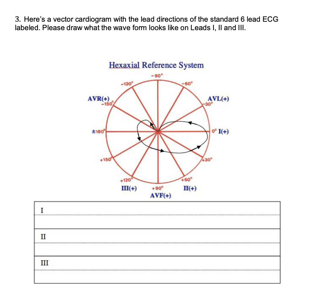 Solved 3. Here's a vector cardiogram with the lead | Chegg.com
