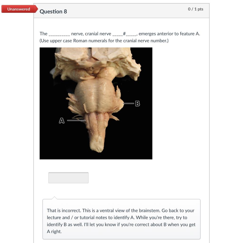 Solved The __________ nerve, cranial nerve _____#_____, | Chegg.com