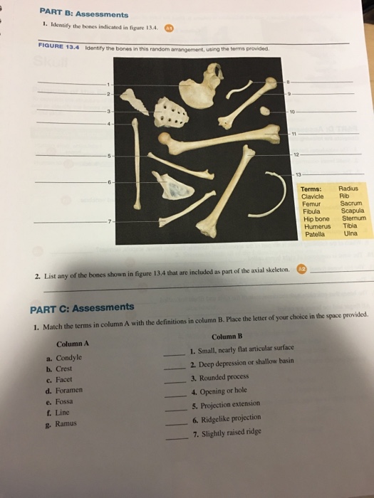Solved Identify the bones indicated in figure 13.4. List | Chegg.com