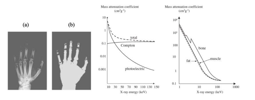Solved Two x-ray images of the hand are shown. One | Chegg.com