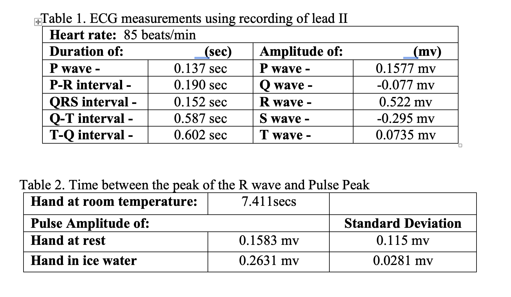 Solved The peak of the R wave is said to occur at about the | Chegg.com