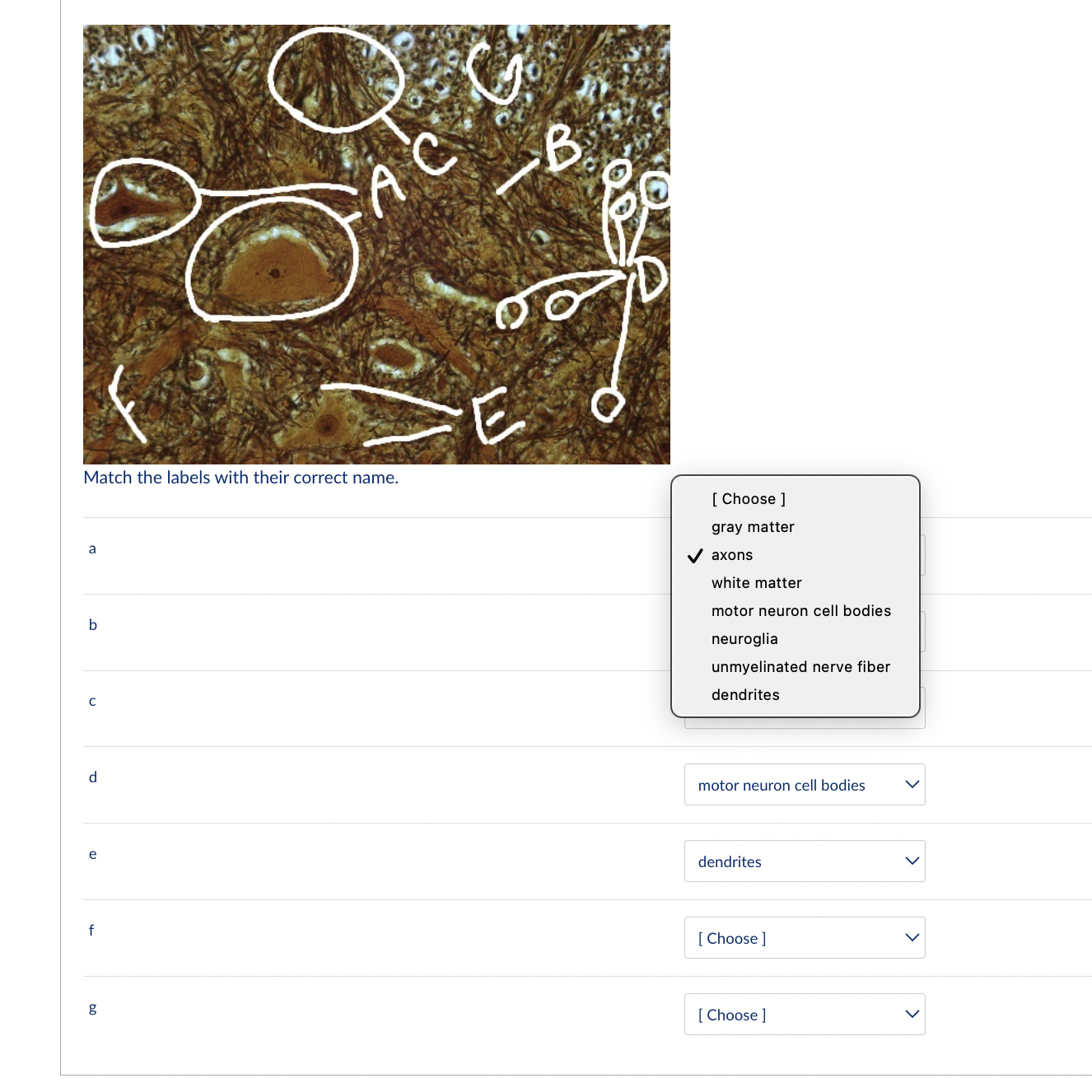 Solved Match the labels with their correct name.abCdefg[ | Chegg.com