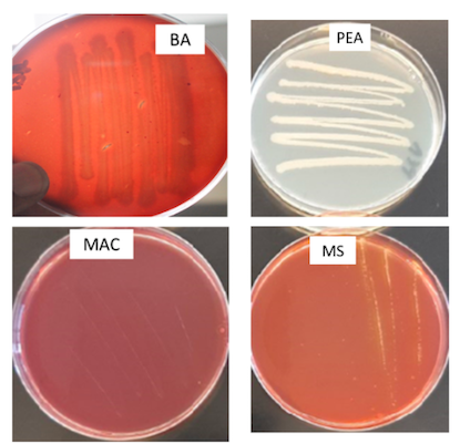 Solved 1. Describe what is in each plate. are they positive | Chegg.com