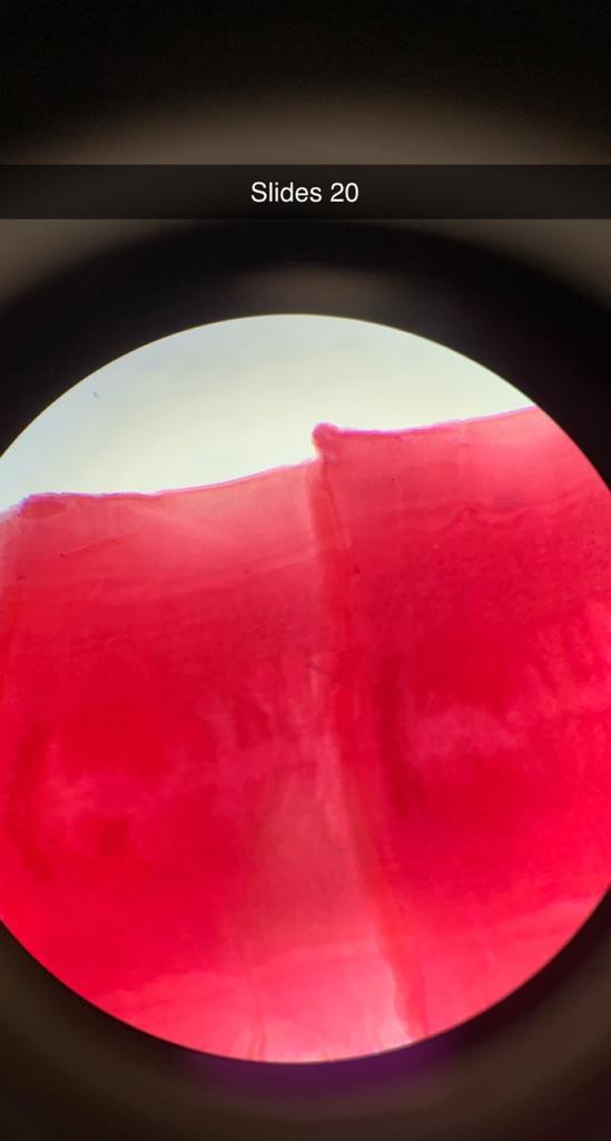 Solved in this slide under microscope we have ''tapeworm | Chegg.com