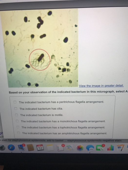 Solved The indicated bacterium has a peritrichous flagella | Chegg.com