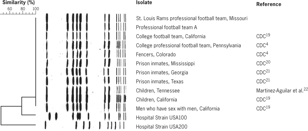 Solved 7. ﻿Study the pulsed-field gel electrophoresis (PFGE) | Chegg.com