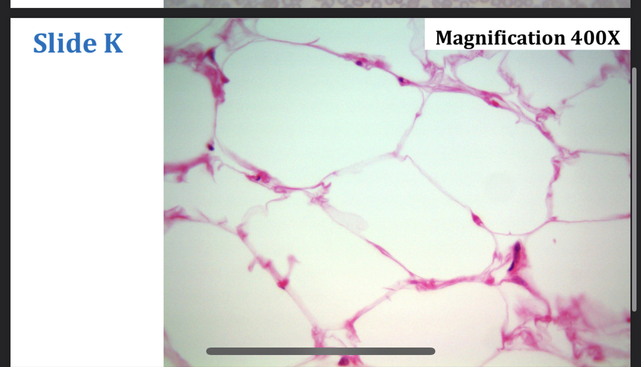 Solved Title of the slide: Slide K Cells are closely packed | Chegg.com