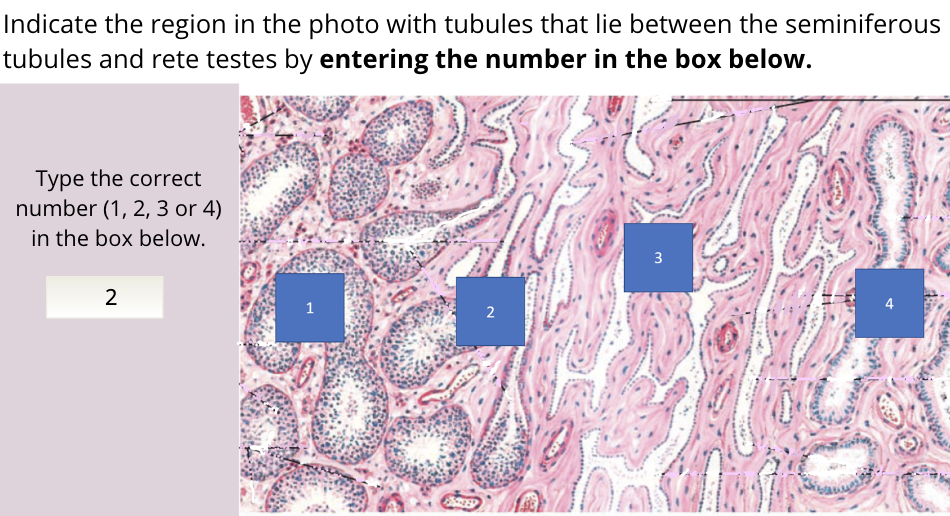 Solved Indicate the region in the photo with tubules that | Chegg.com