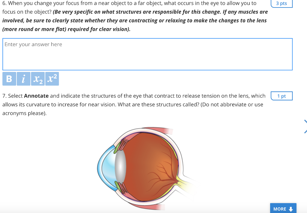 Solved 3 pts 6. When you change your focus from a near | Chegg.com