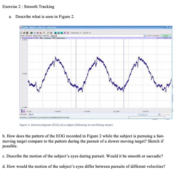 Solved Exercise 2: Smooth Tracking a. Describe what is seen | Chegg.com