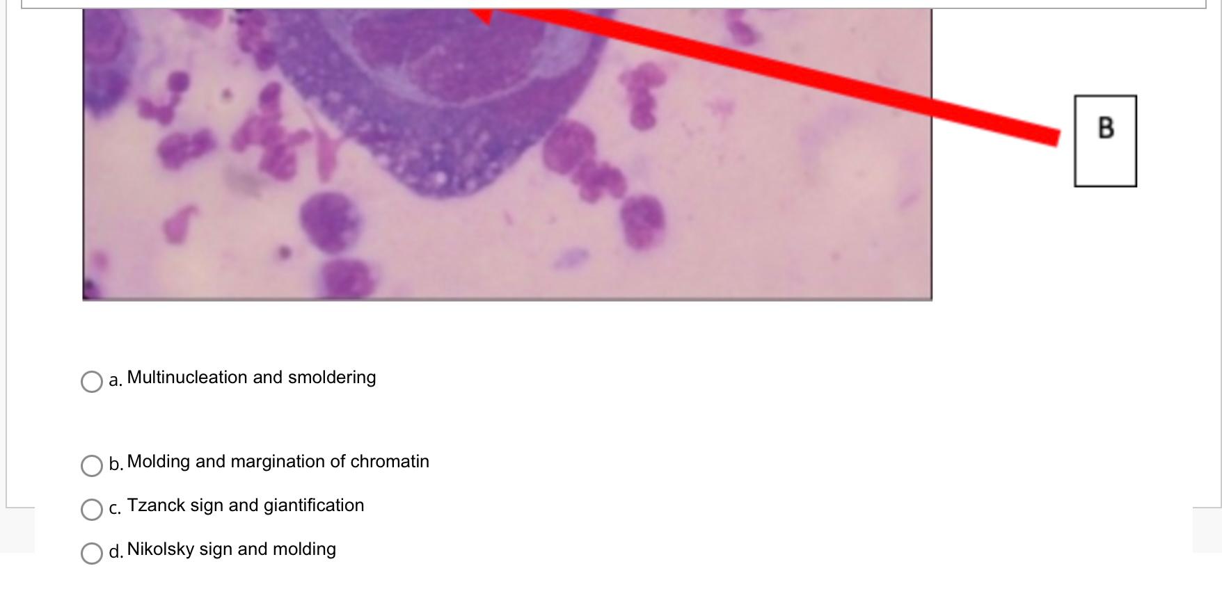 Solved In the Tzanck smear above the Blue arrow marked A, | Chegg.com