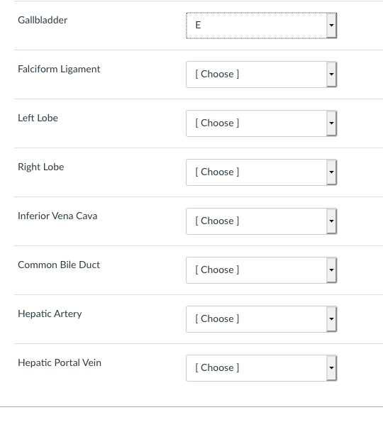 Solved A B F C H G D E Gallbladder E Falciform Ligament | Chegg.com