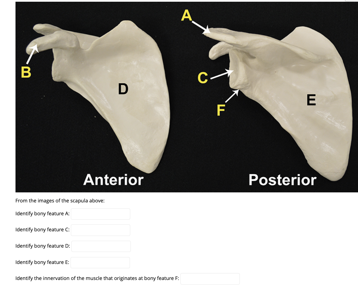 Solved From the images of the scapula above: Identify bony | Chegg.com Solved From the images of the scapula above: Identify bony | Chegg.com