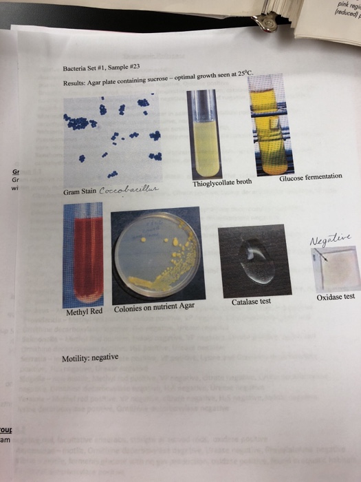 Solved Can anyone help me identify what bacteria this is | Chegg.com
