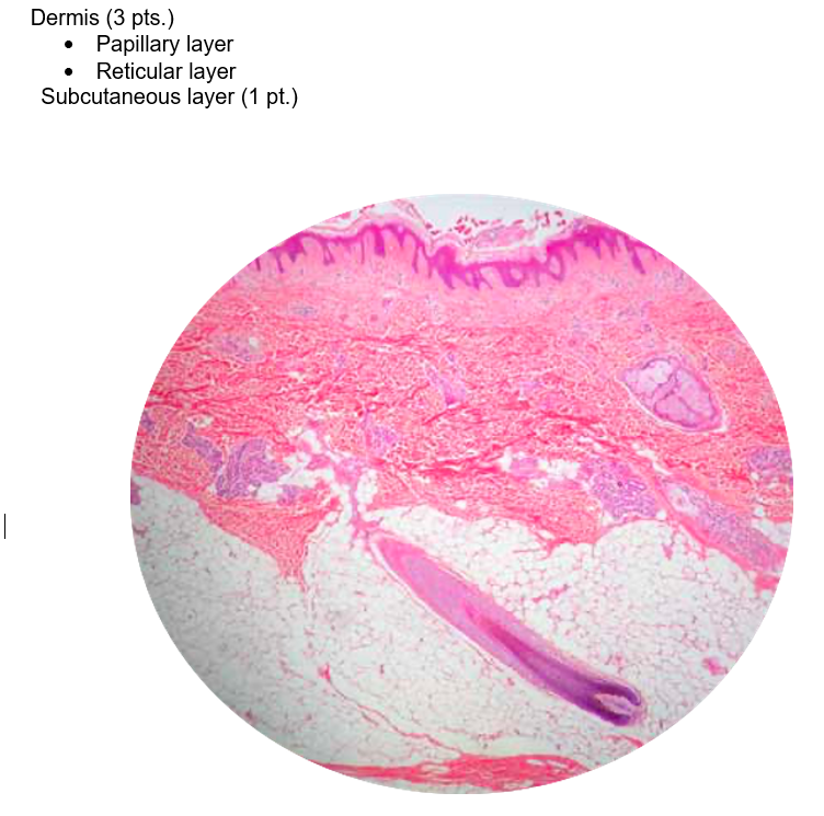 Solved Dermis (3 pts.) • Papillary layer Reticular layer | Chegg.com