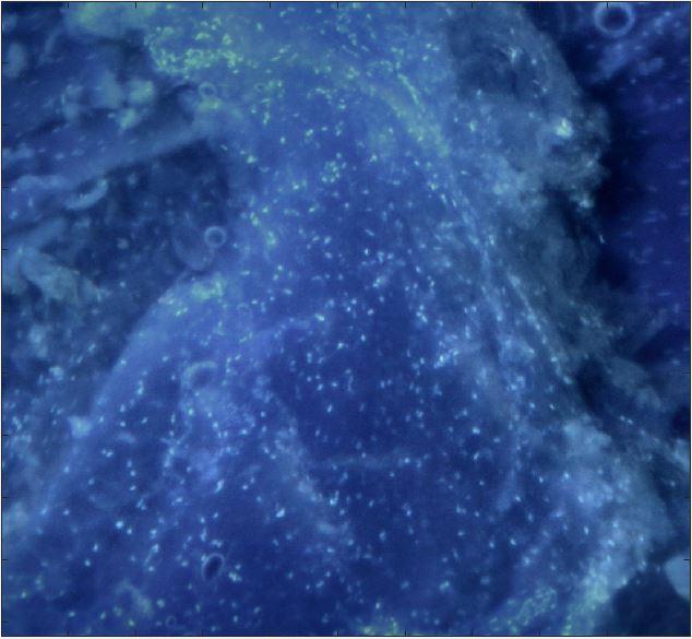 Solved Perform histogram equalization on tissue_im by | Chegg.com