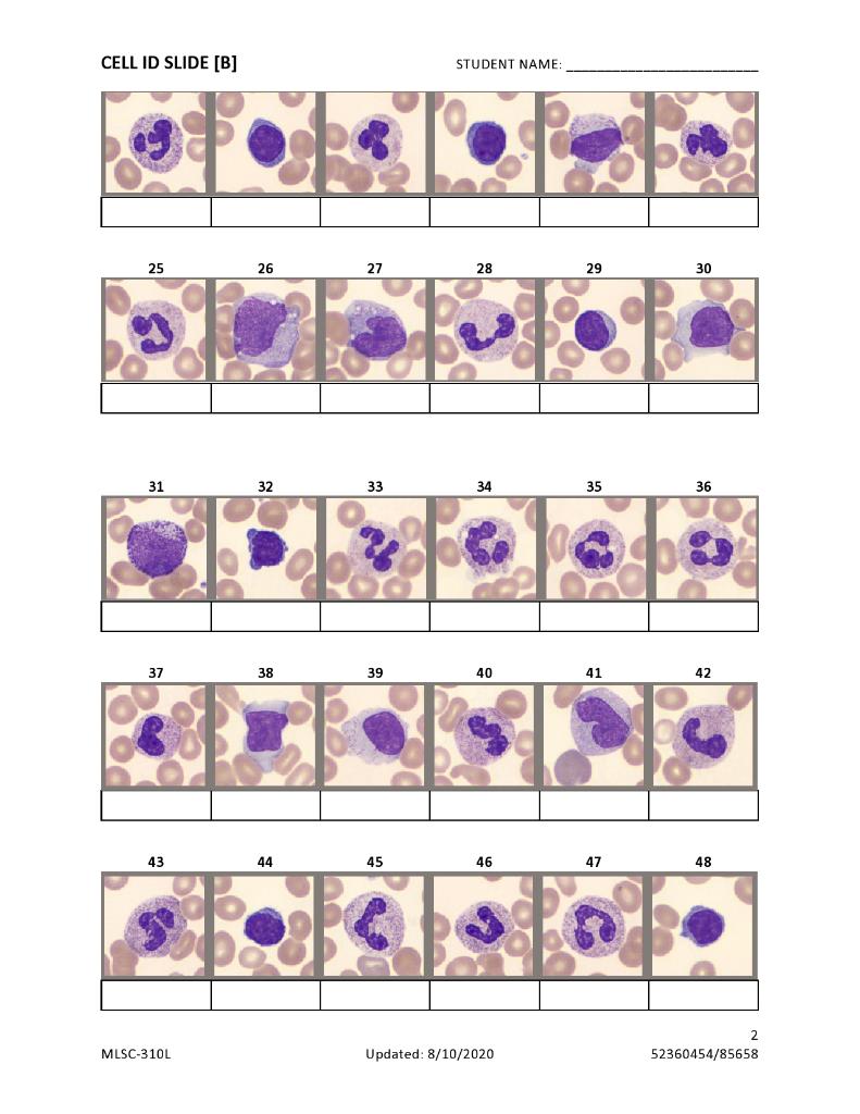 Solved CELL ID SLIDE [B] STUDENT NAME: WBC Differential: | Chegg.com