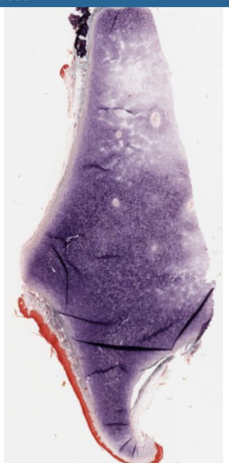 Solved I need help in labeling: 1) elastic cartilage 2) | Chegg.com