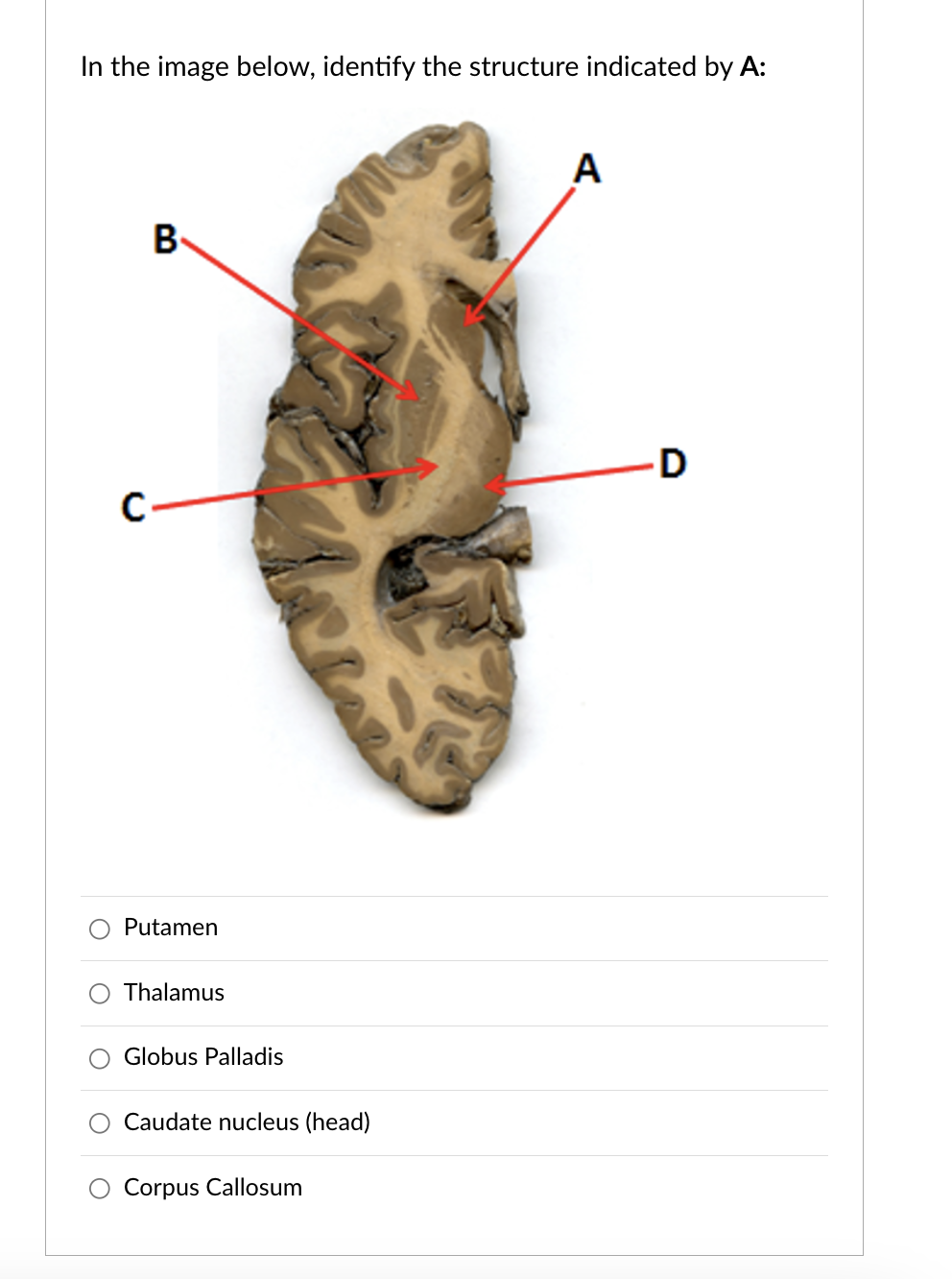 Solved In the image below, identify the structure indicated | Chegg.com