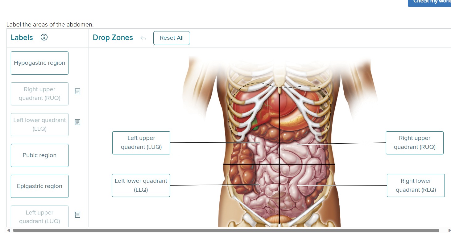 Solved Label the areas of the abdomen. | Chegg.com