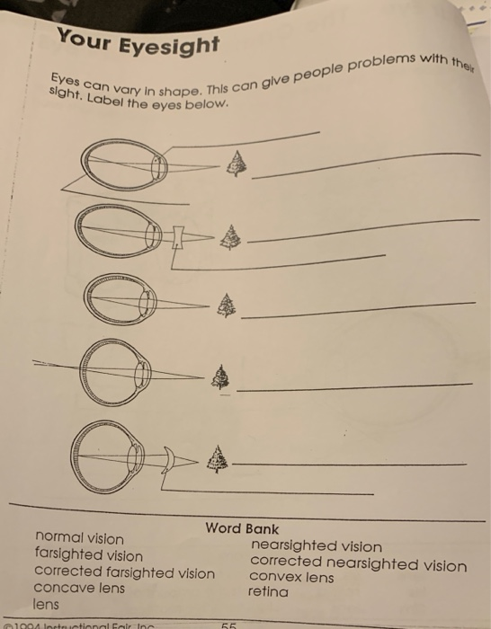 Solved our Eyesight Eyes can vary in shape sight. Label the | Chegg.com