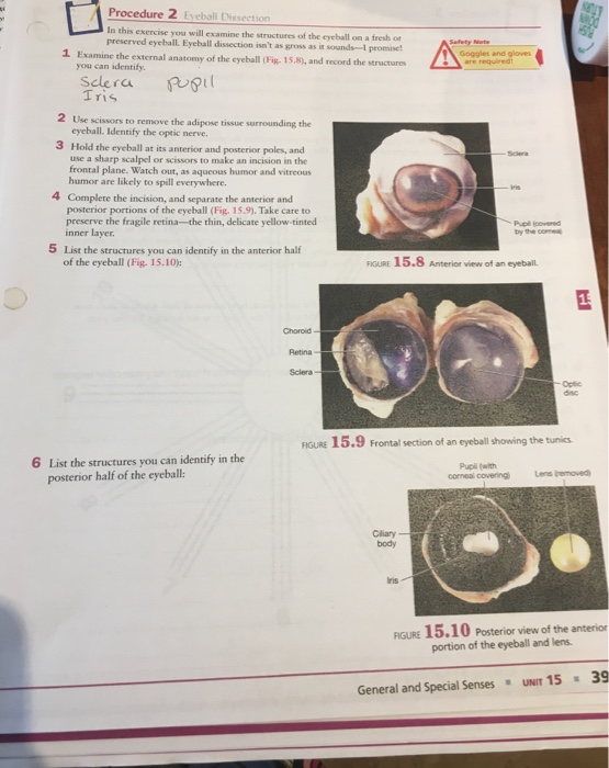 Solved Procedure 2 Eyebali Dissection In this exercise you | Chegg.com