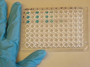 Solved Several patient serum samples were sent to the | Chegg.com