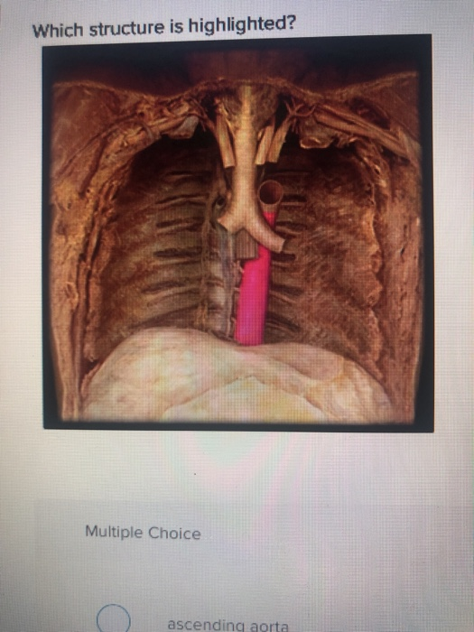Solved Which structure is highlighted? Multiple Choice | Chegg.com Solved Which structure is highlighted? Multiple Choice | Chegg.com