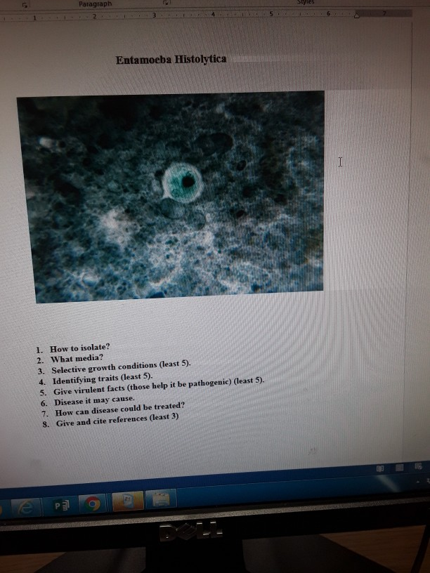 Solved Paragraph Entamoeba Histolytica 1. How to isolate? 2. | Chegg.com