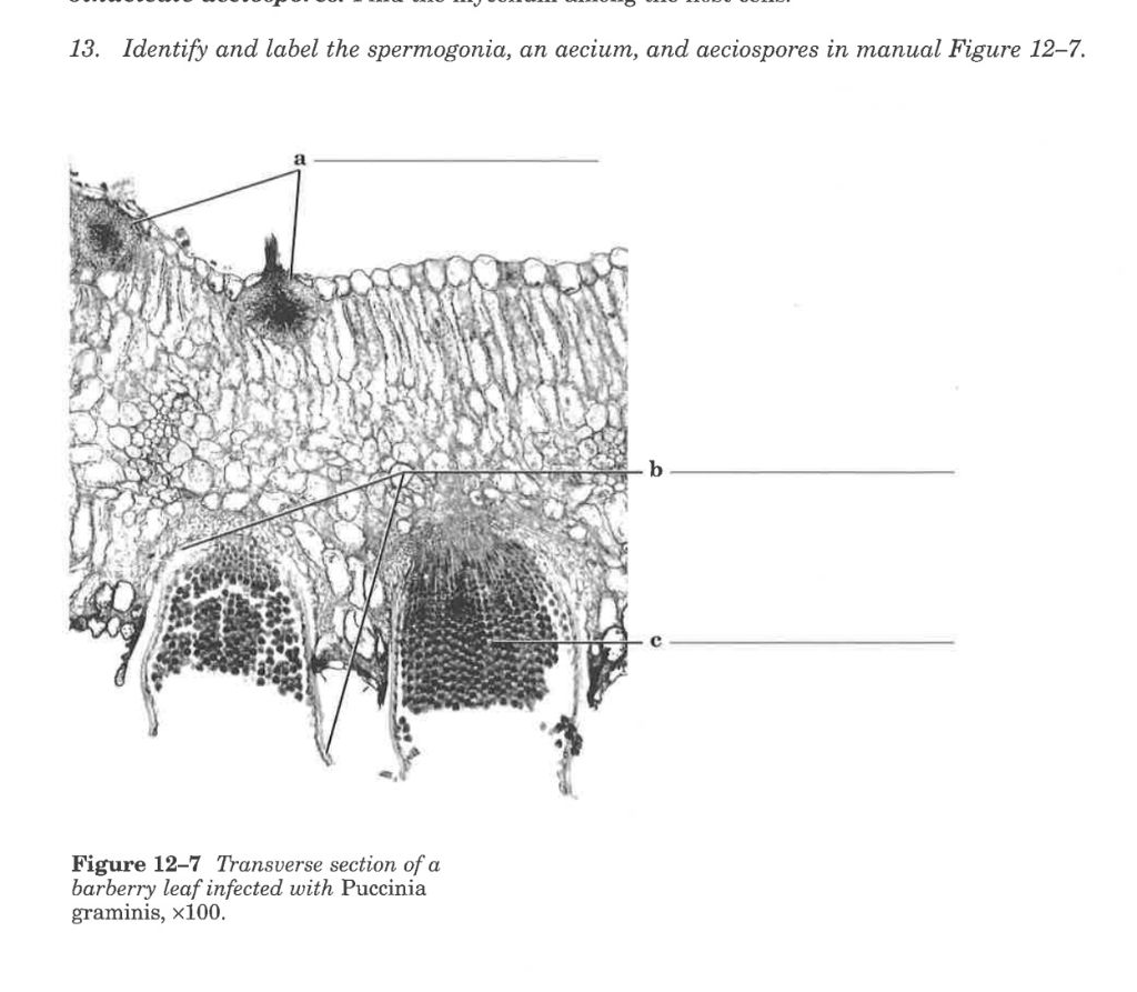 Solved 13. Identify and label the spermogonia, an aecium, | Chegg.com
