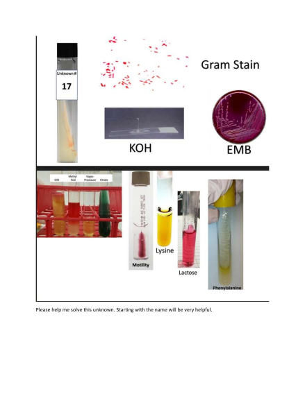 Solved Gram Stain Unknown 17 KOH EMB Lysine Motility Lactose | Chegg.com