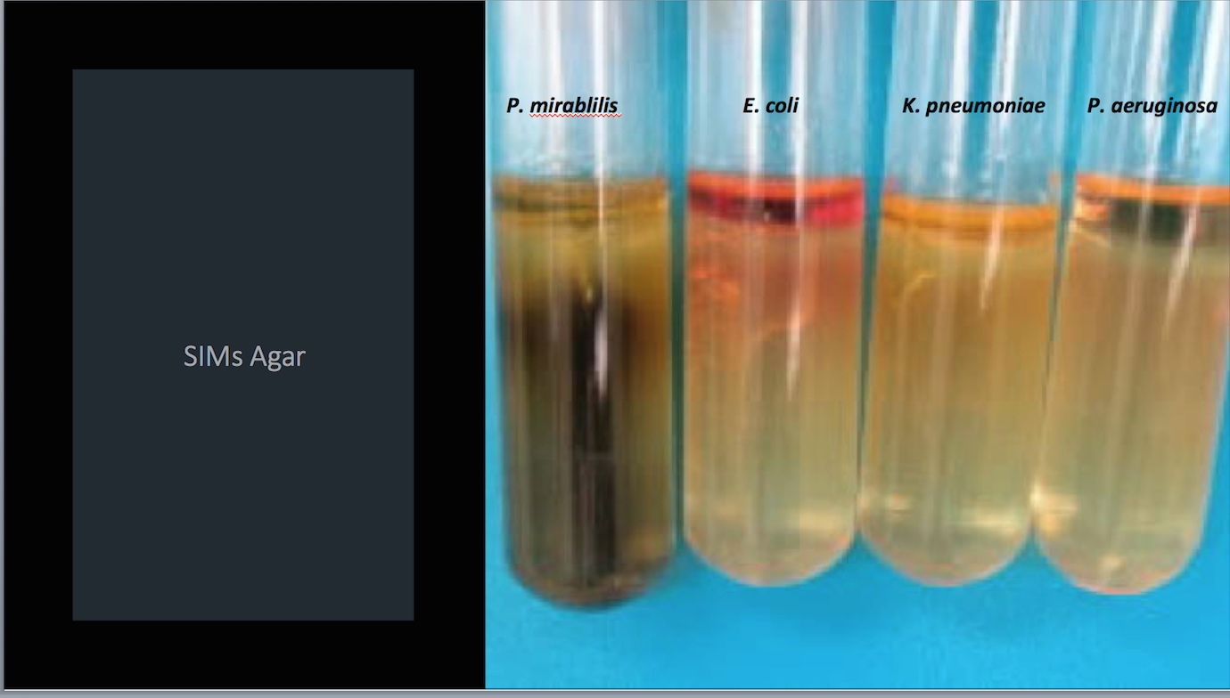 Solved Exercise 5: Clinical Test of Gram-Negative Bacteria | Chegg.com