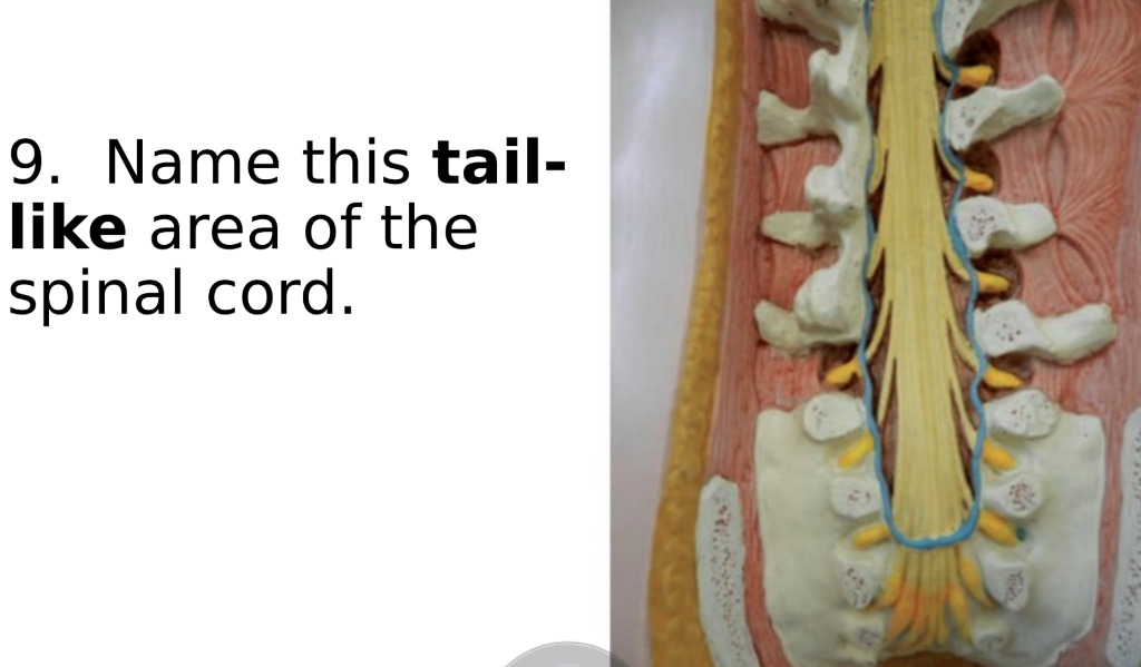 Solved 9. Name this tail- like area of the spinal cord. | Chegg.com