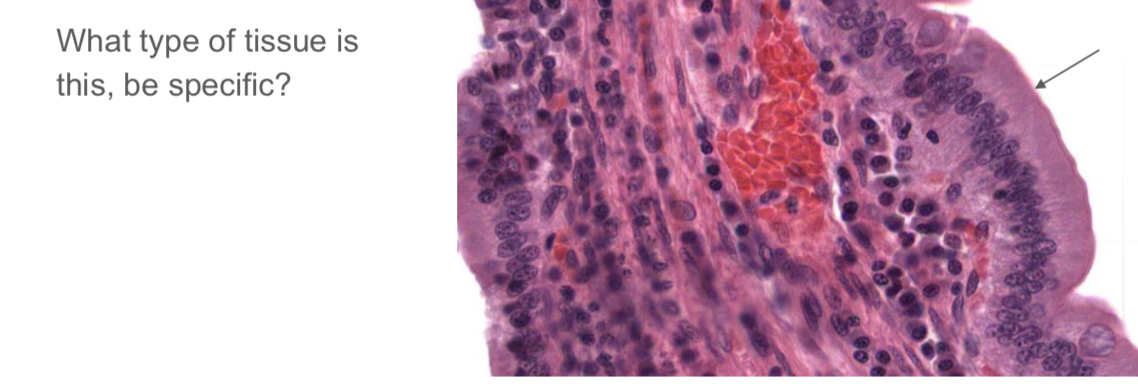 Solved What Cells Is The Arrow Pointing To Hint Are They Chegg solved-what-cells-is-the-arrow-pointing-to-hint-are-they-chegg