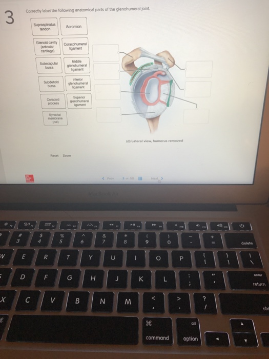 Solved Correctly label the following anatomical parts of the | Chegg.com